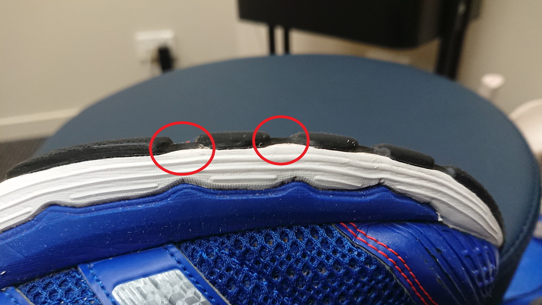 Know When to Change Your Shoes - Capital Physiotherapy